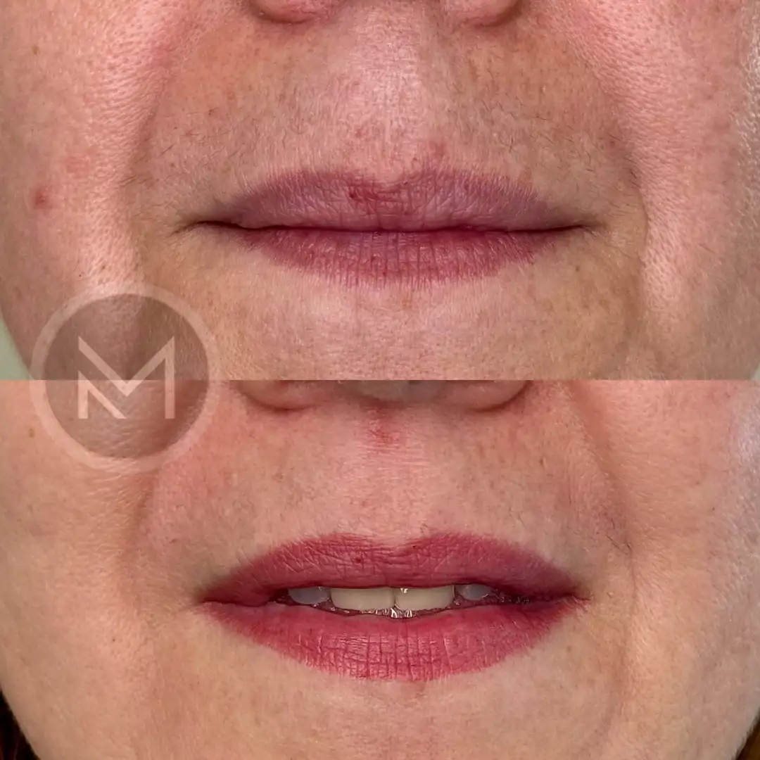 Micropigmentación de labios: todo lo que debes saber para ir siempre ...